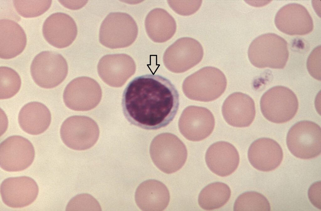 Fun Quiz: Hematology Cell Identification - The Mislabeled Specimen Fun ...