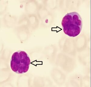 Fun Quiz: Hematology Cell Identification - The Mislabeled Specimen Fun ...